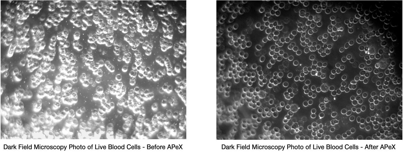 APeX Immunity Booster - Oxygen Therapy - Vital Vibe Source